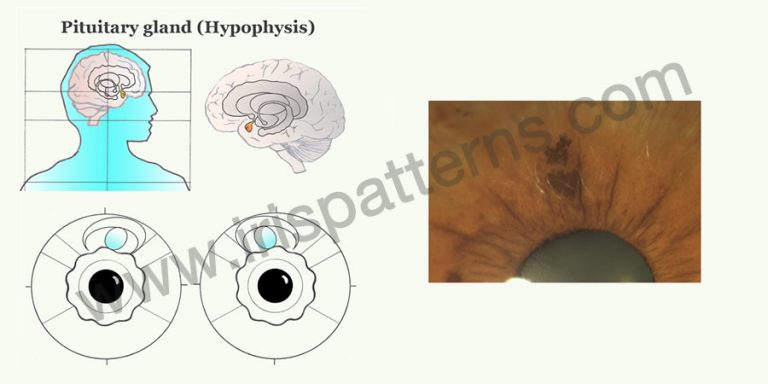 Iris Markings - The Basics of Iridology
